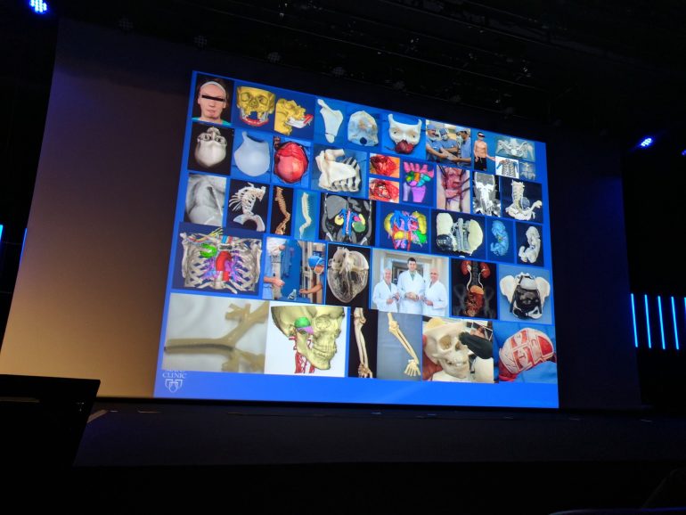 最佳医疗，牙科和医疗保健应用3D打印2018 - 3D打印行业江南平台版江南平台版